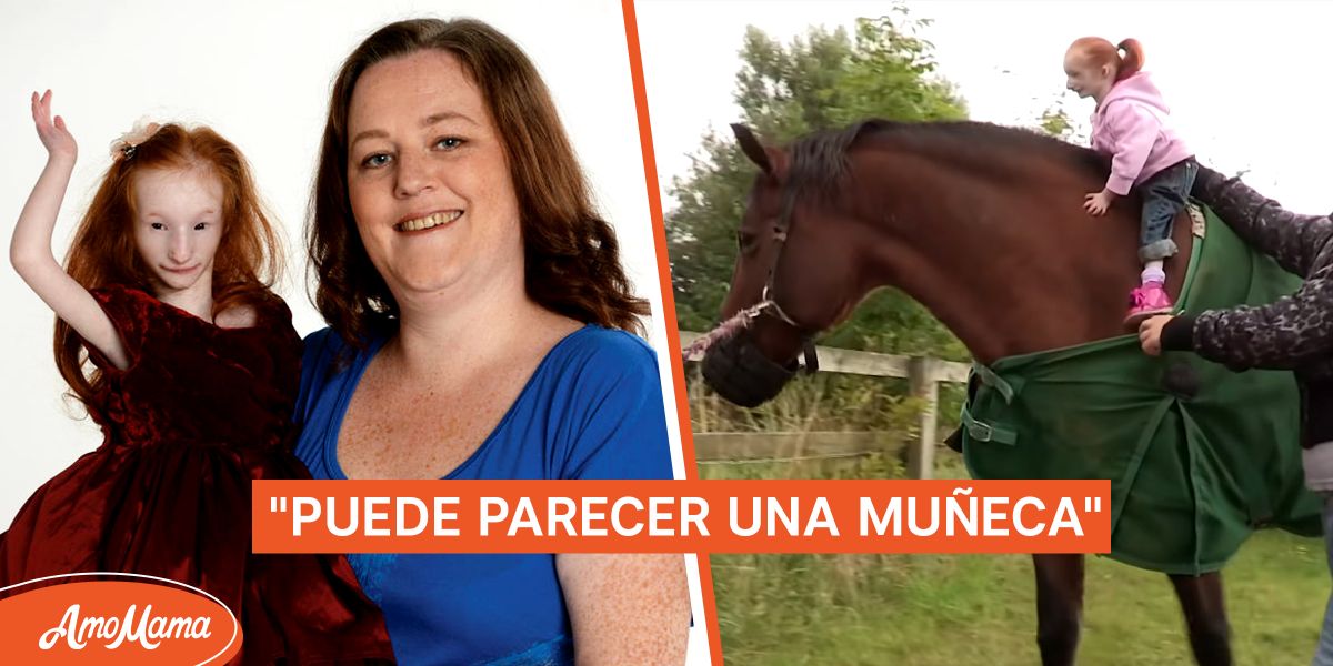 La bebé más pequeña del mundo ya tiene 16 – Creció y luce "hermosa ...
