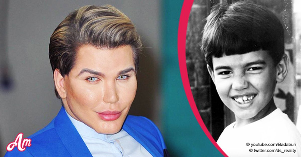 La increíble transformación del "Ken Humano" tras gastar 300.000 ...