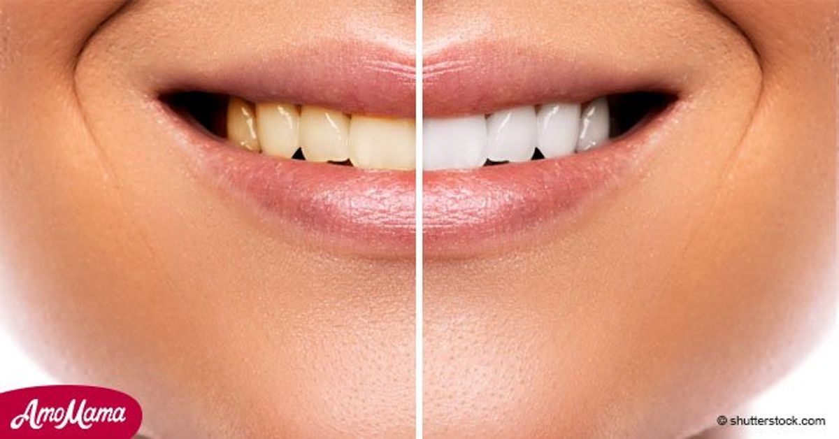 Así es como podrías obtener unos dientes más blancos usando cáscara de ...