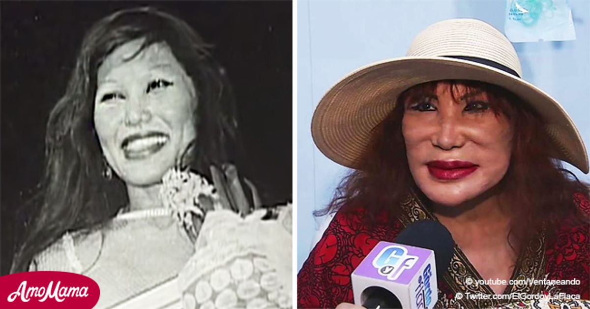 Lyn May ya tiene 67 años y se someterá a más cirugías en el cuerpo y el ...