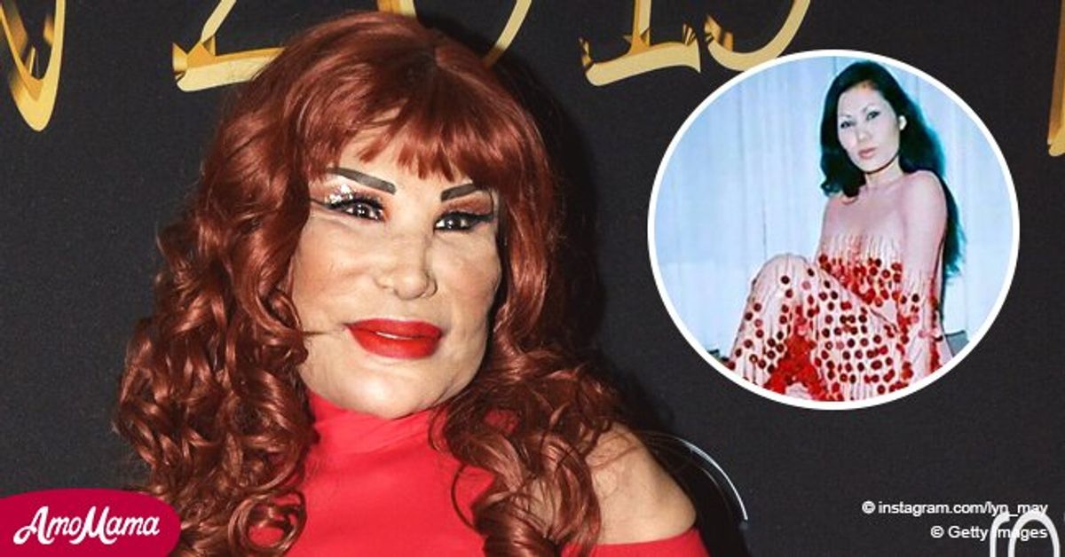 La apariencia de Lyn May antes de las cirugías y el mal procedimiento ...