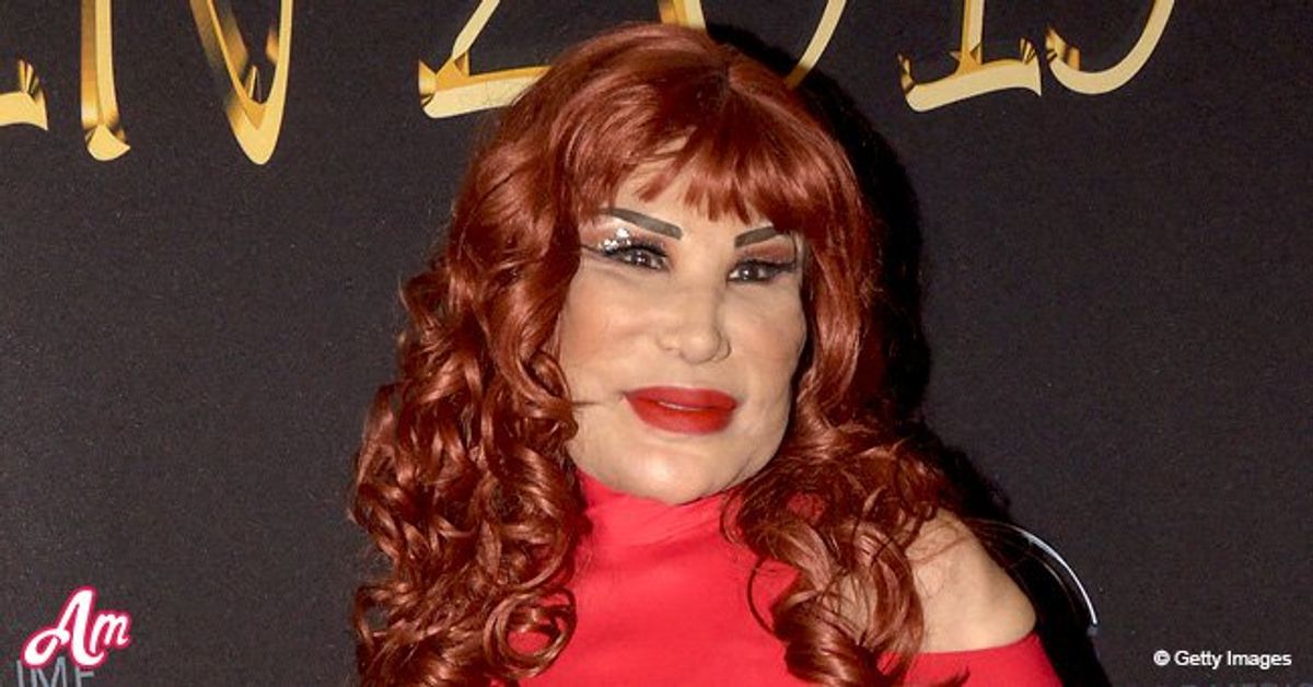 Lyn May entrará al quirófano para comenzar el 2020 con nueva imagen
