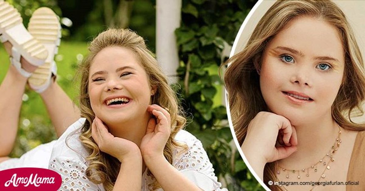 Adolescente con síndrome de Down se convierte en una sensación de ...