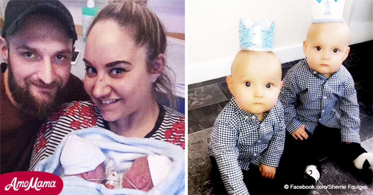 Gemelos celebran su primer cumpleaños tras sobrevivir una cirugía con ...