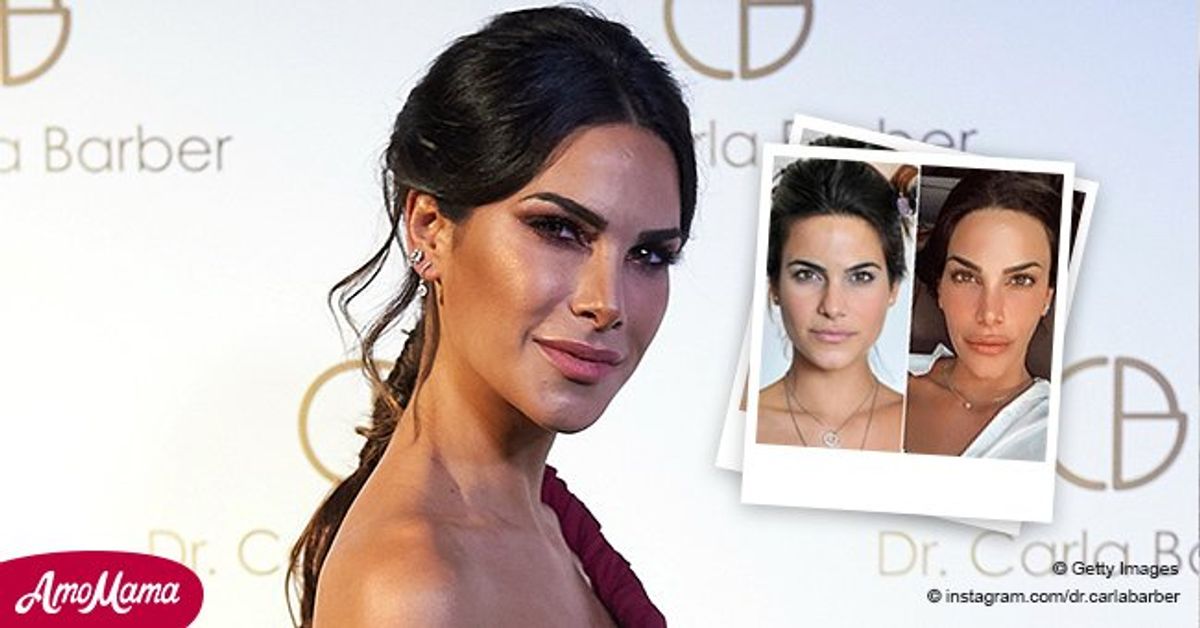 Carla Barber enseña cómo cambió su cara tras 10 años y varios retoques ...