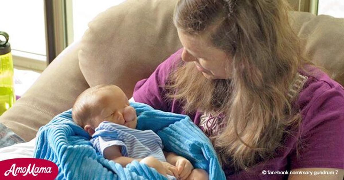 Padres de bebé que nació con severa deformación enfrentaron decisión ...
